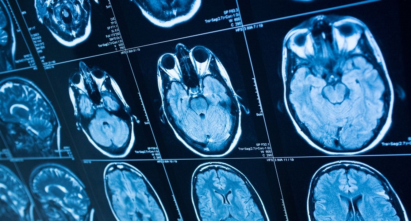 As isolation nears its dreary end, we need a plan for brain health ...